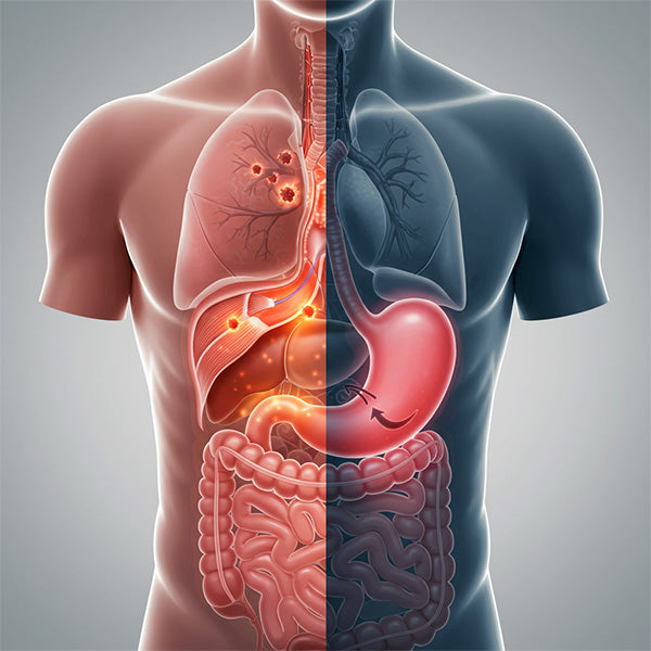 Understanding Acid Reflux: What It Is, Why It Happens, and How to Mana ...